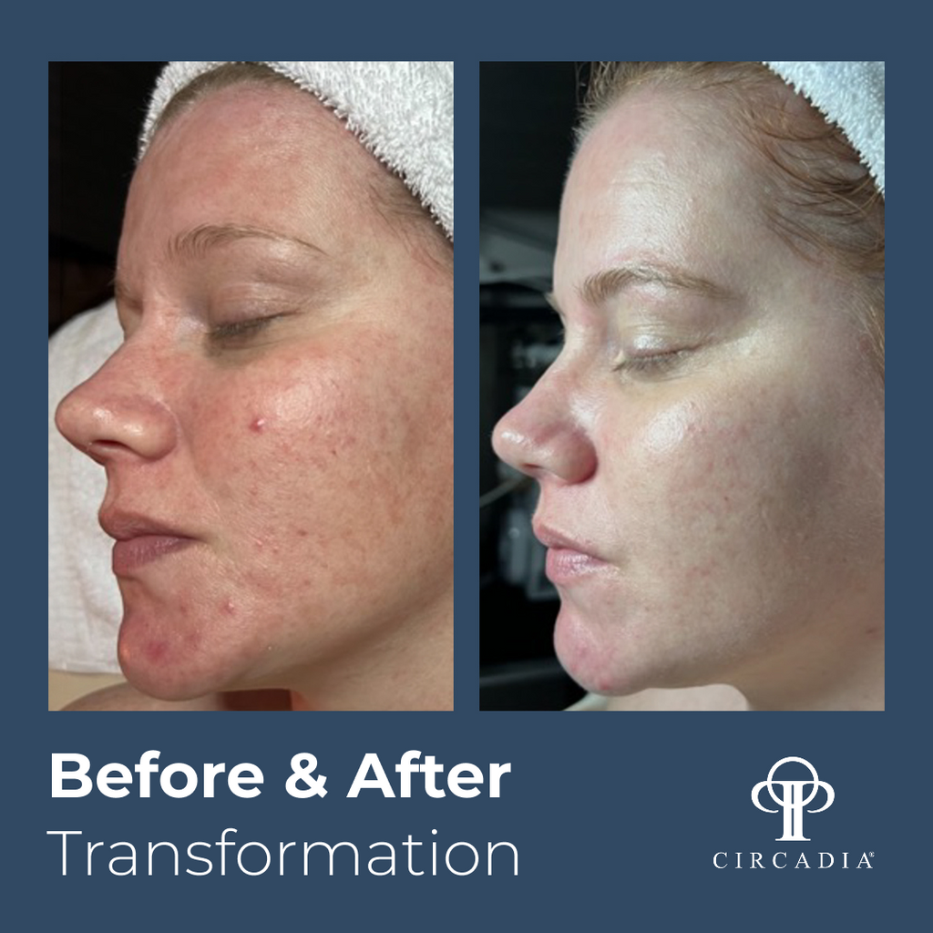 Calming Signature Facial Complete Bundle | CIRCADIA