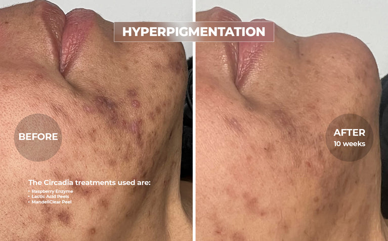 Real Results | CIRCADIA