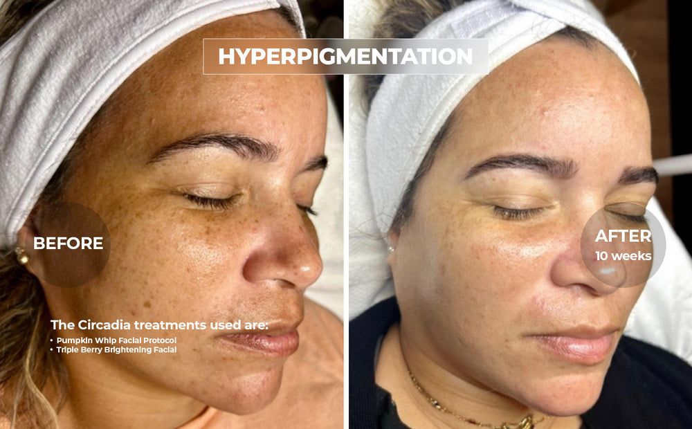 Real Results | CIRCADIA