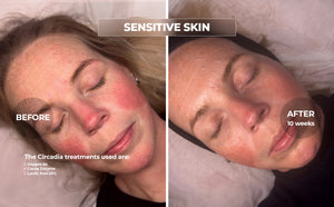 Real Results | CIRCADIA