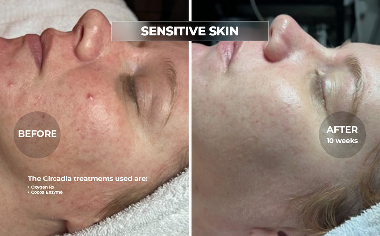 Real Results | CIRCADIA