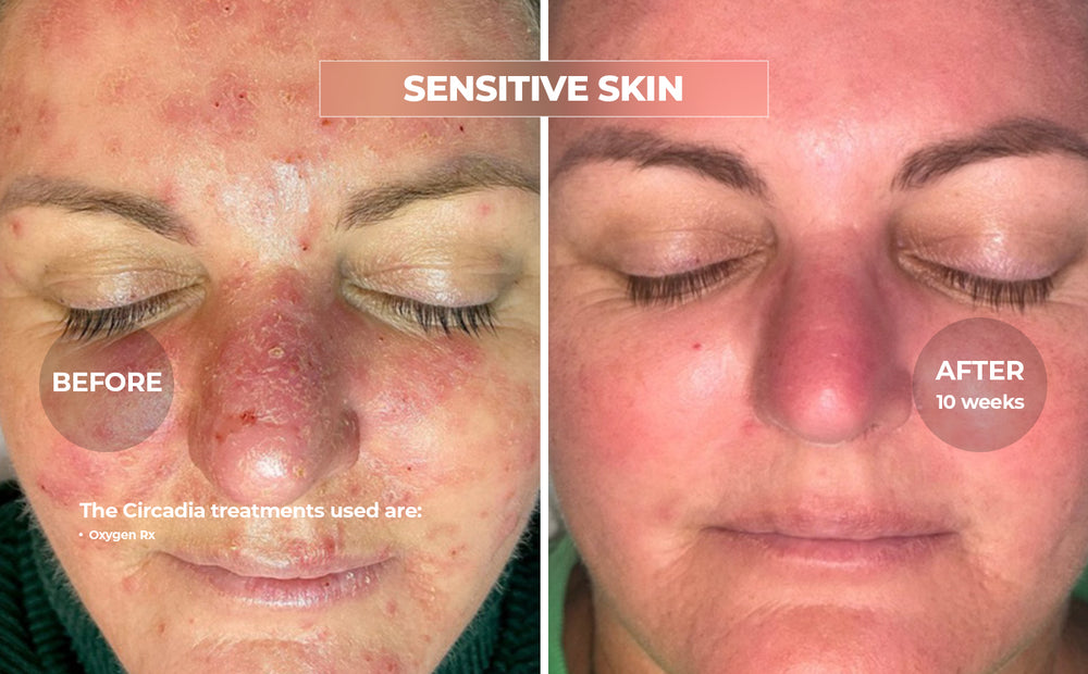 Real Results | CIRCADIA