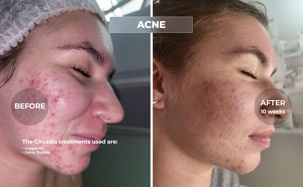 Real Results | CIRCADIA