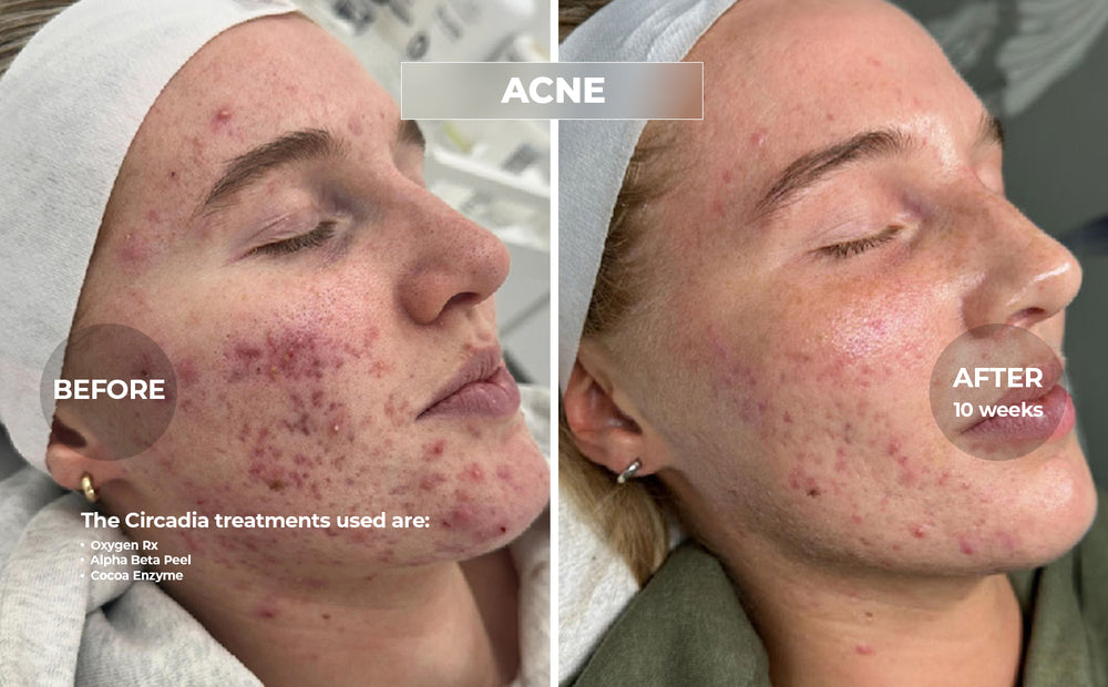 Real Results | CIRCADIA