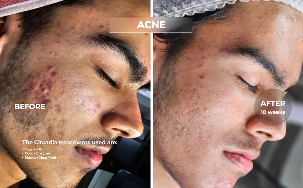 Real Results | CIRCADIA