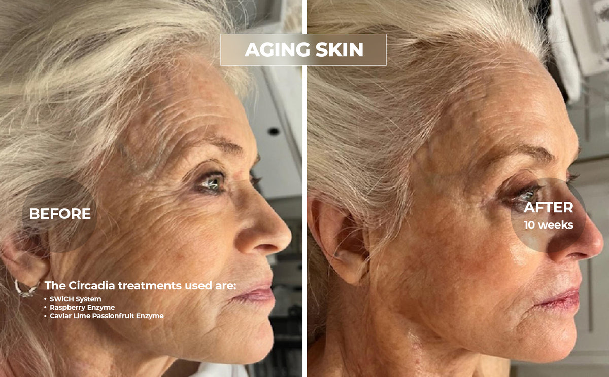 Real Results | CIRCADIA