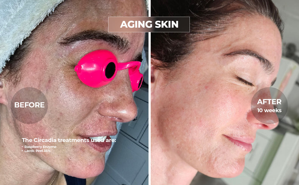 Real Results | CIRCADIA