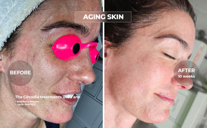 Real Results | CIRCADIA