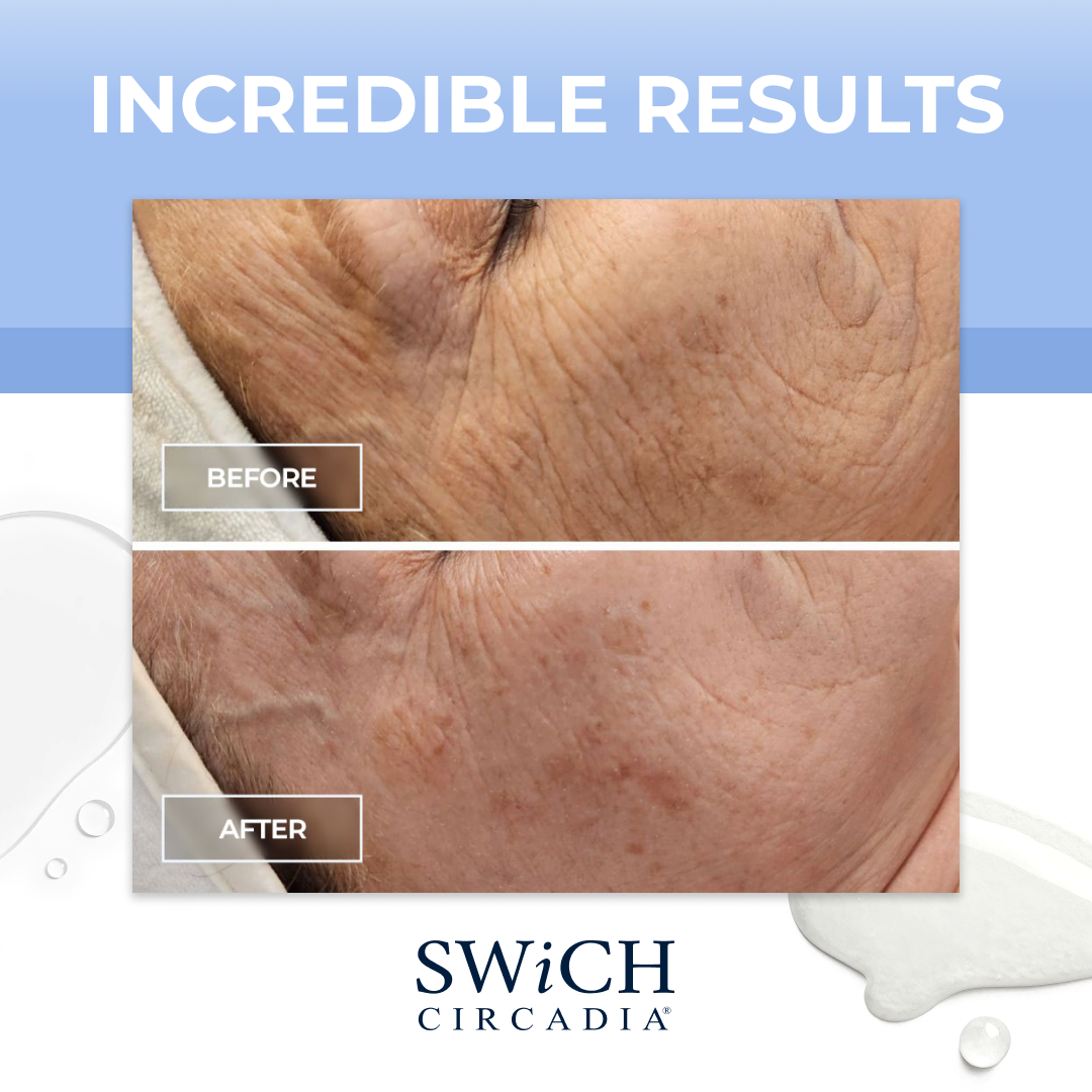 SWiCH Signature Facial | CIRCADIA