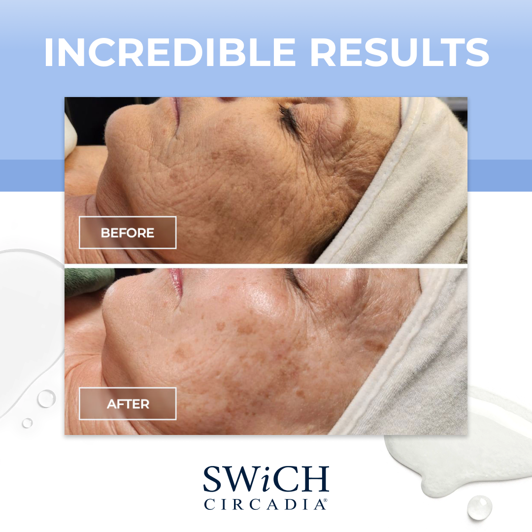 SWiCH Signature Facial | CIRCADIA