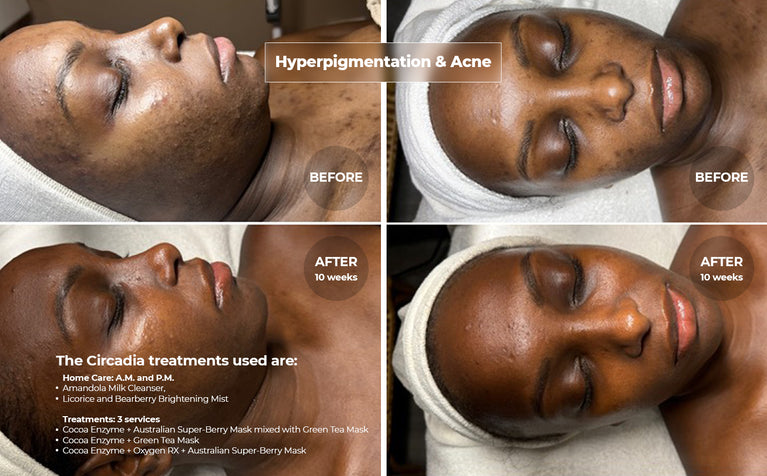 Real Results | CIRCADIA