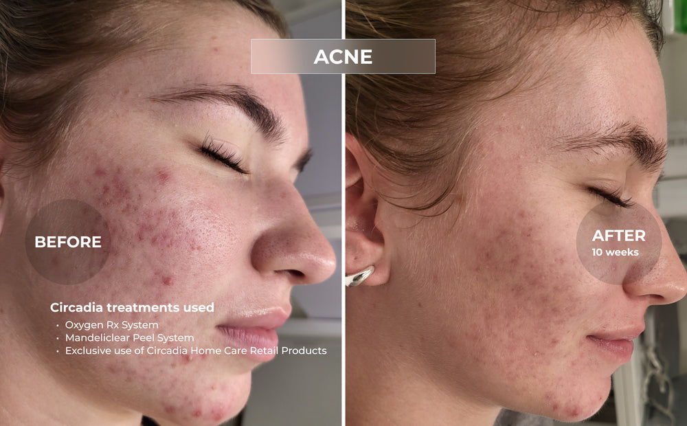 Real Results | CIRCADIA