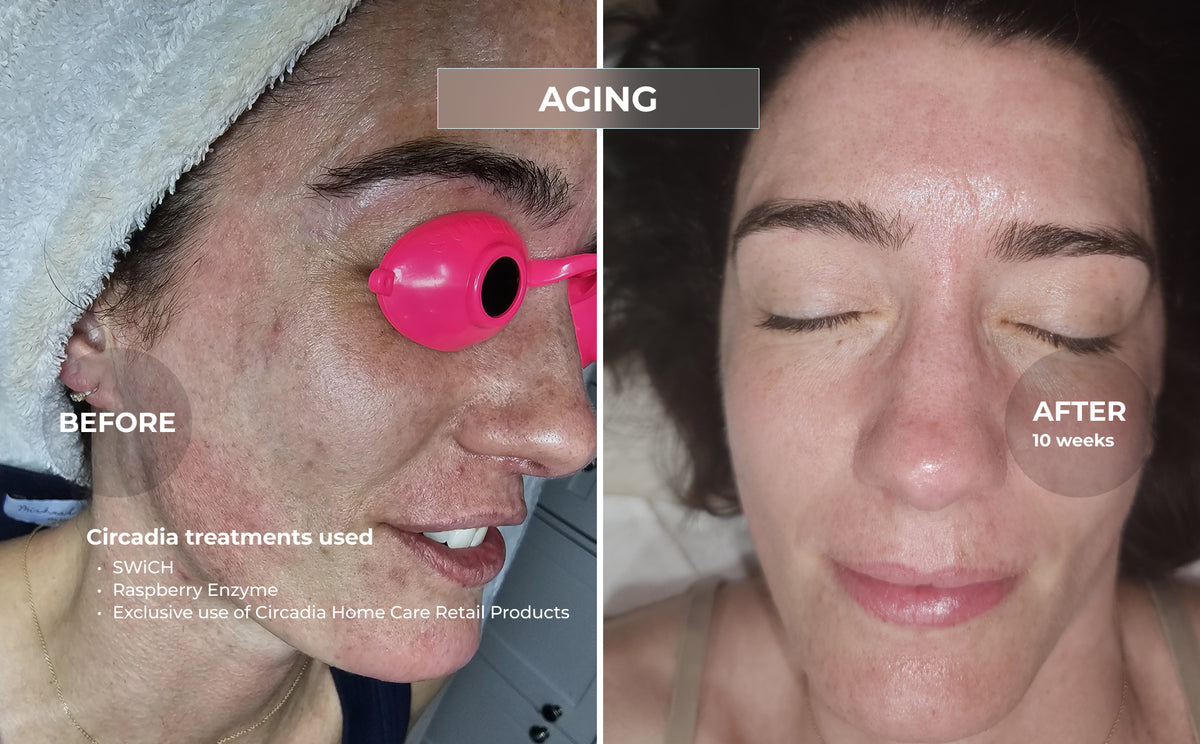 Real Results | CIRCADIA