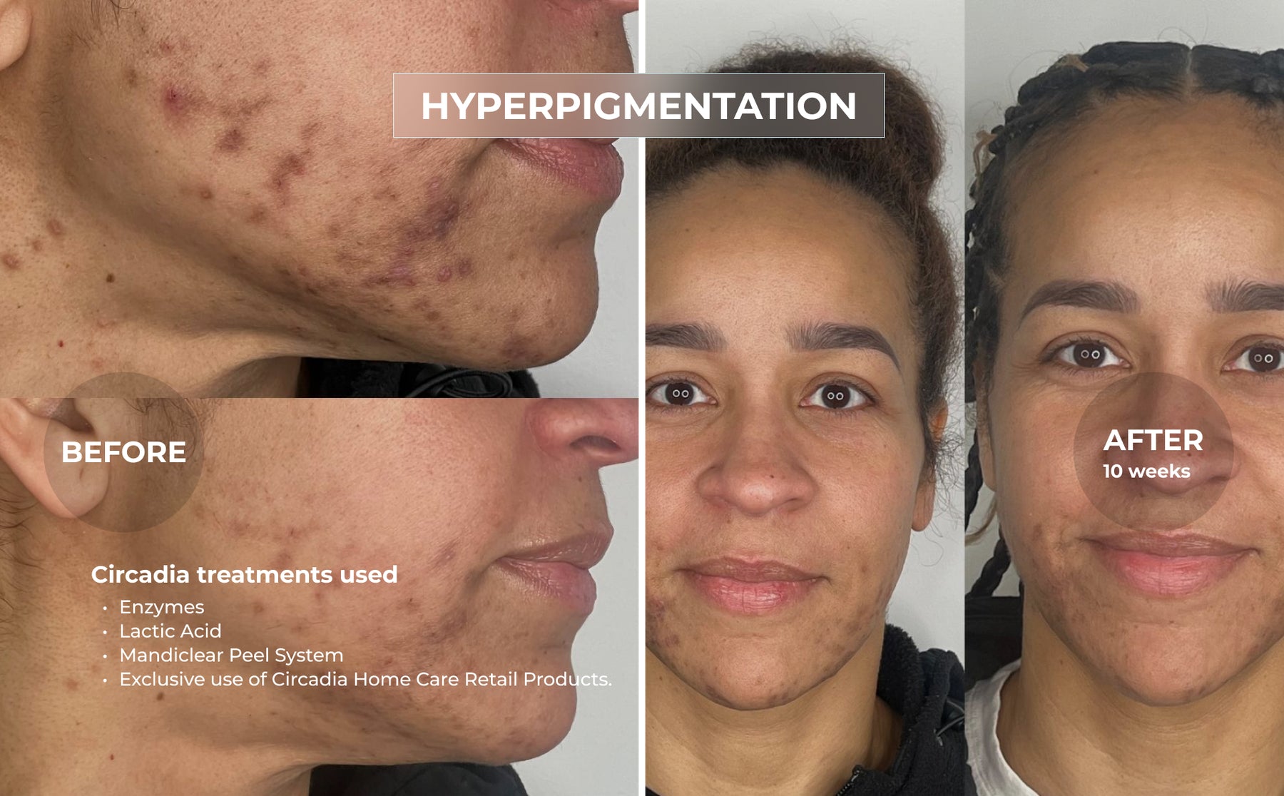 Real Results | CIRCADIA