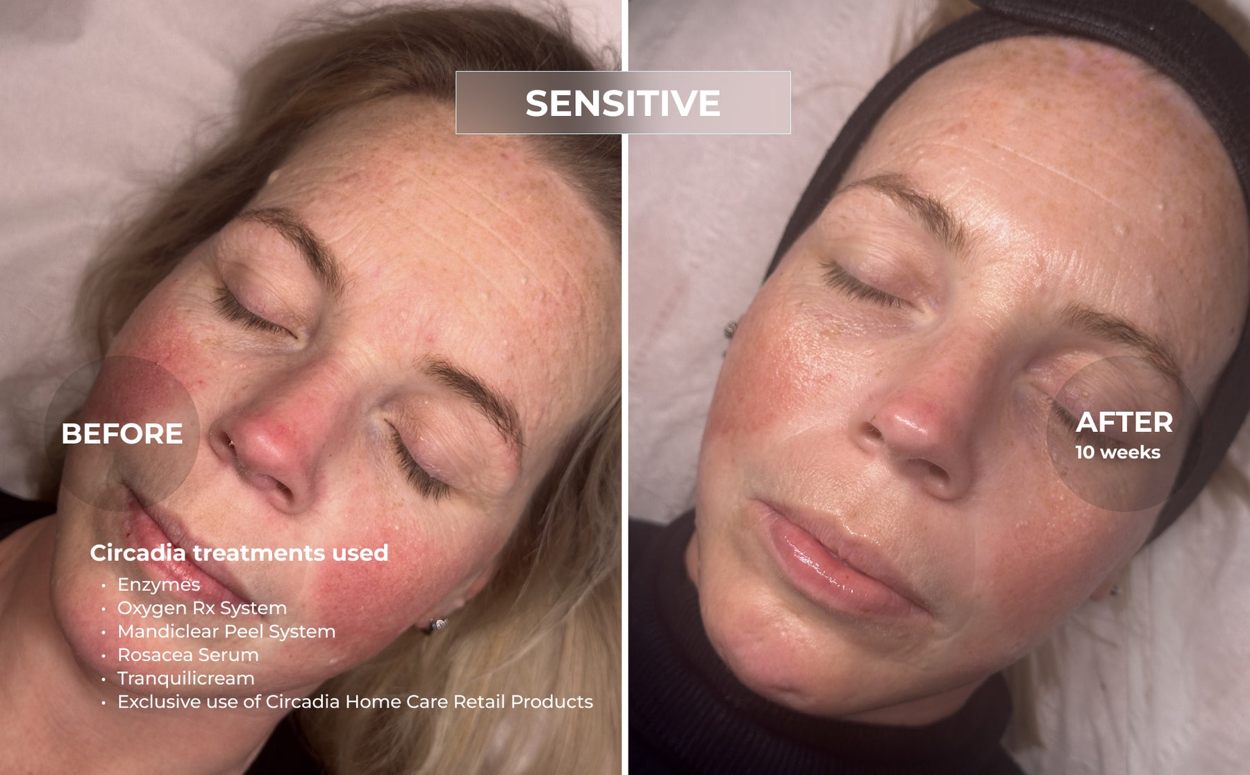 Real Results | CIRCADIA