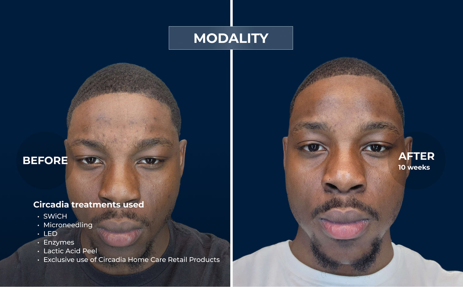 Real Results | CIRCADIA